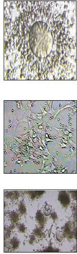 A IVF procedure called CAT is Developed by Dr. Firuza Parikh