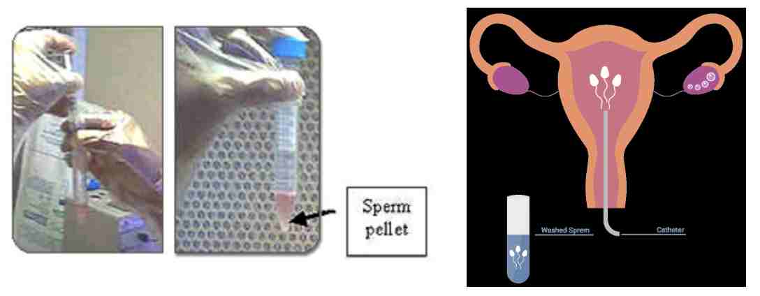 Available Facilities For Fertility Enhancement - Fertiltree