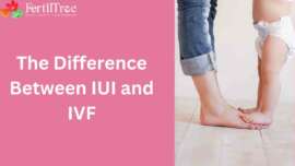 IUI vs IVF: The Procedures, Success Rates and Duration