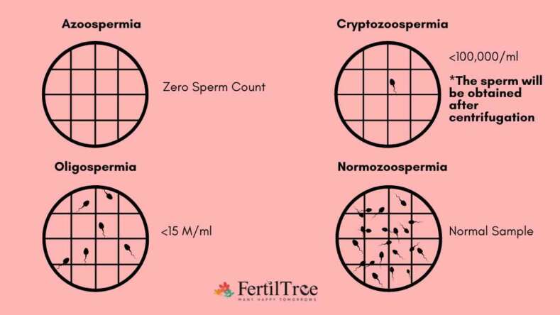 Difference Between Azoospermia And Oligospermia | Fertiltree